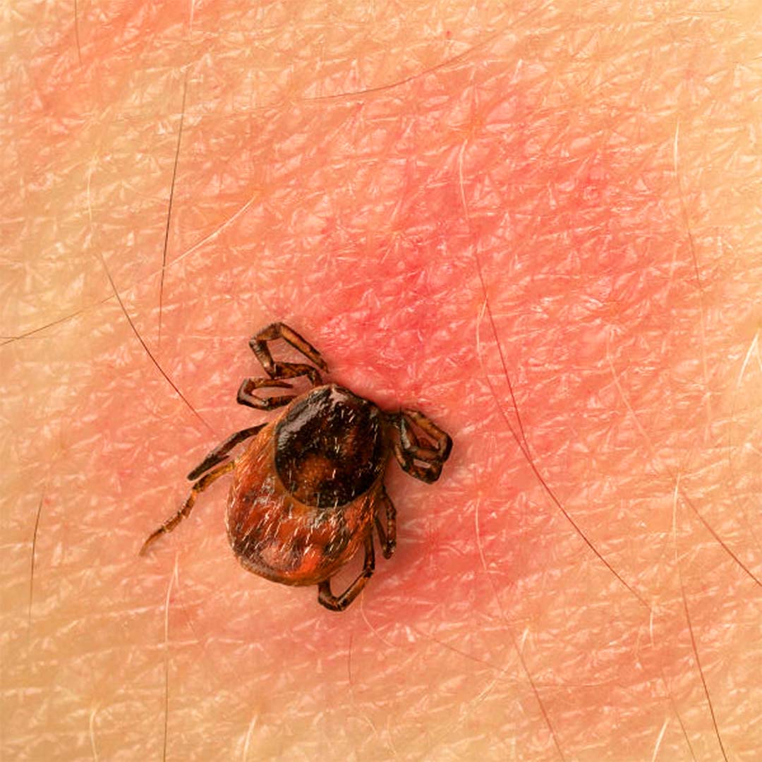 Resources | Tick Prevention & Tips, Guides & Helpful Info on Ticks